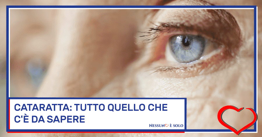 Cataratta: tutto quello che c'è da sapere | Nessuno è Solo